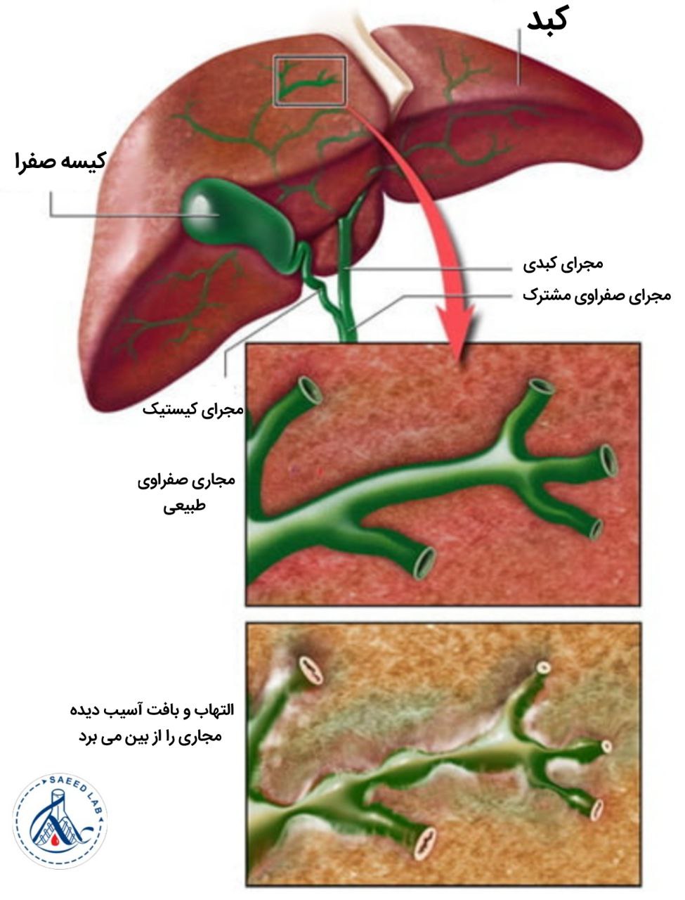 آزمایش AMA و AMA-M2: کلید تشخیص بیماری های کبدی - آزمایشگاه سعید